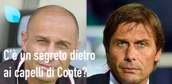 Conte Trapianto Capelli: il segreto nascosto. - HairClinic.it