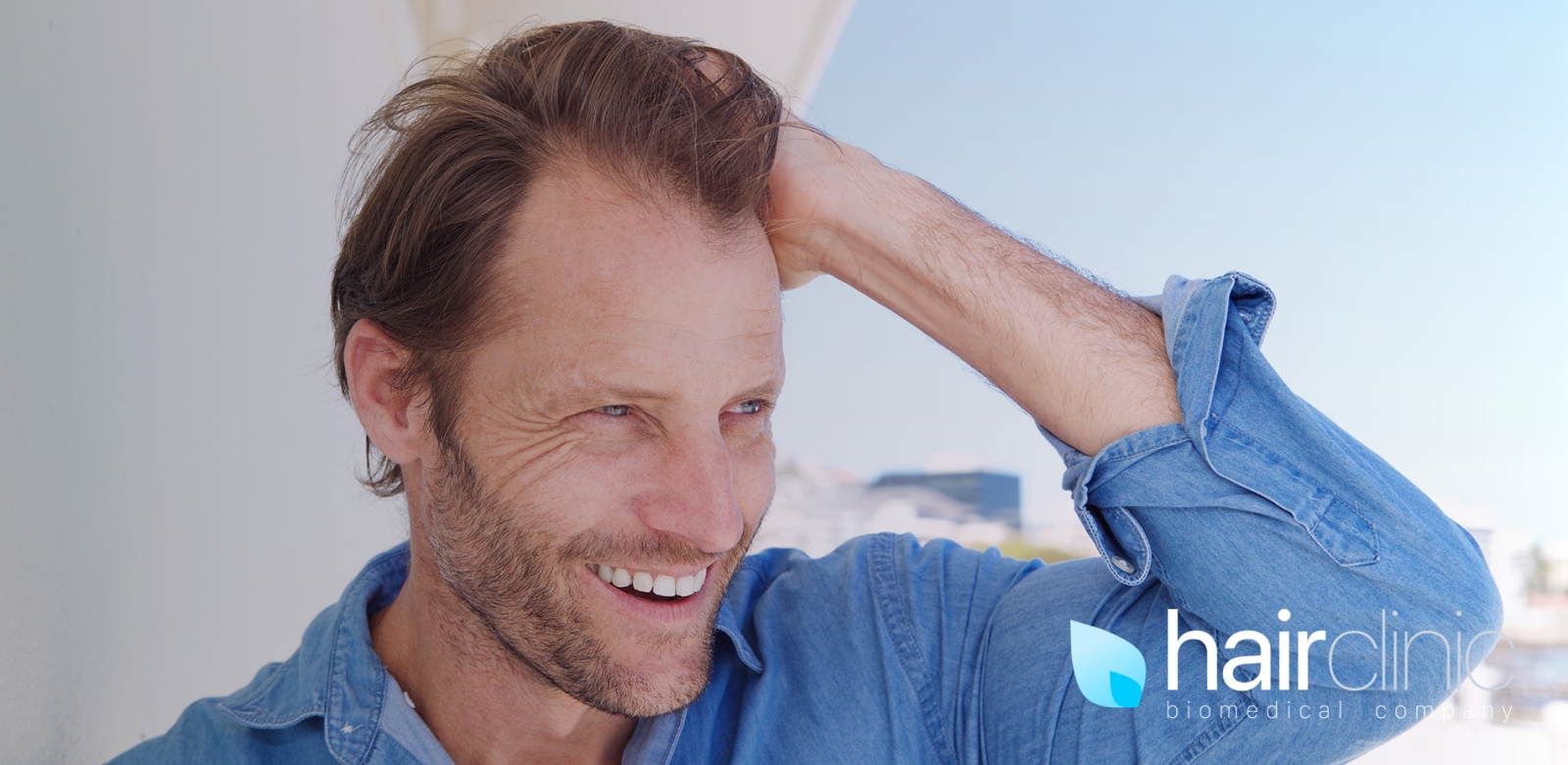 Alopecia tipologie ed efficaci metodi di cura