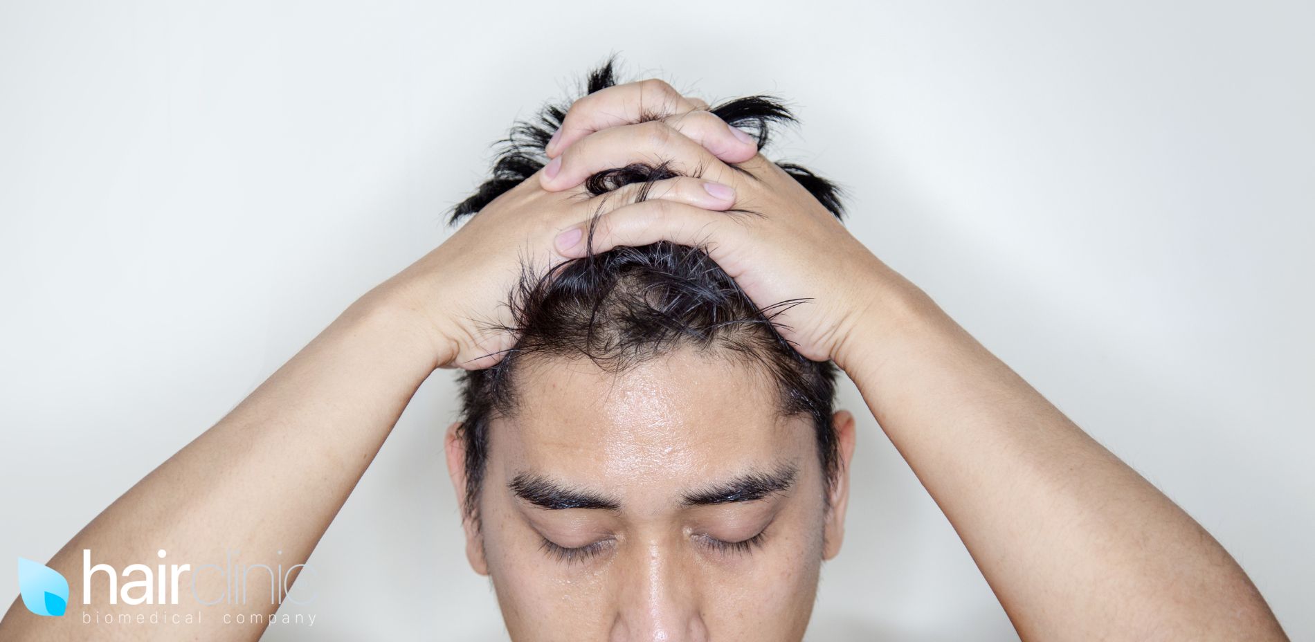 Ecklonia cava: un’alga diventa il tuo supporto contro la calvizie ...